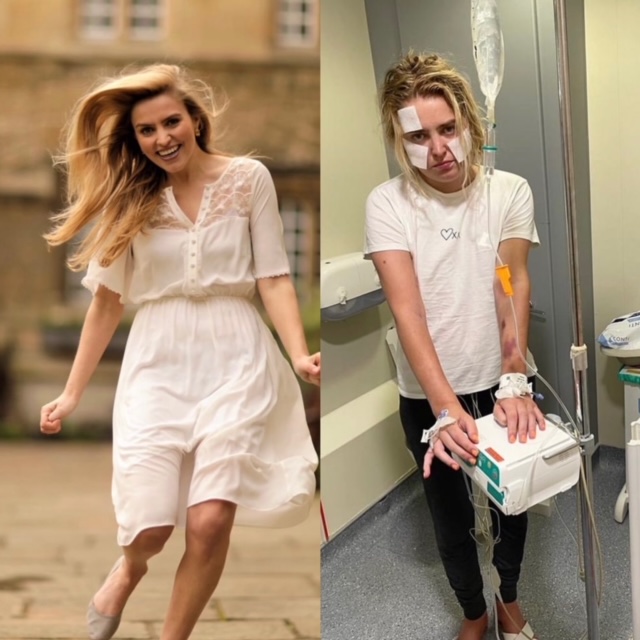 Be Patient – My EDS Story by Tilly Rose - The Ehlers-Danlos Support UK